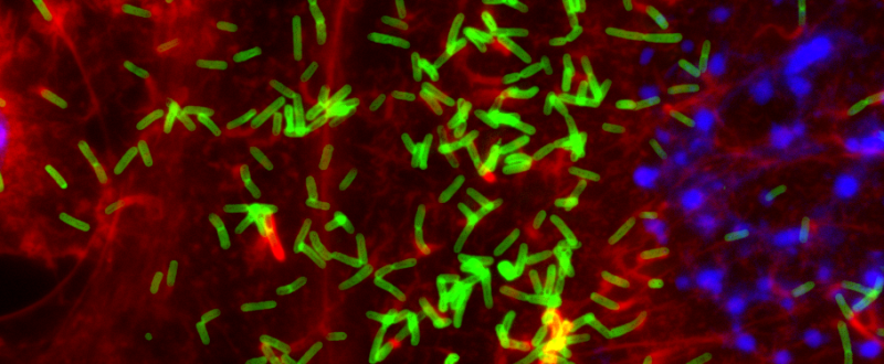 UW Microbiology Home | UW Microbiology